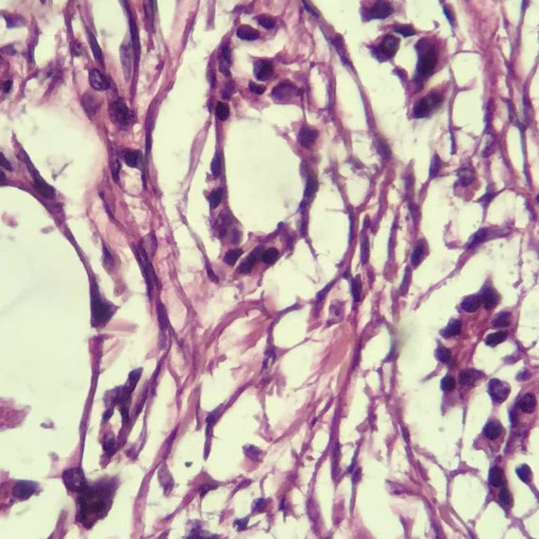 Home - DataBiox ..::: AI / Data Driven Solutions